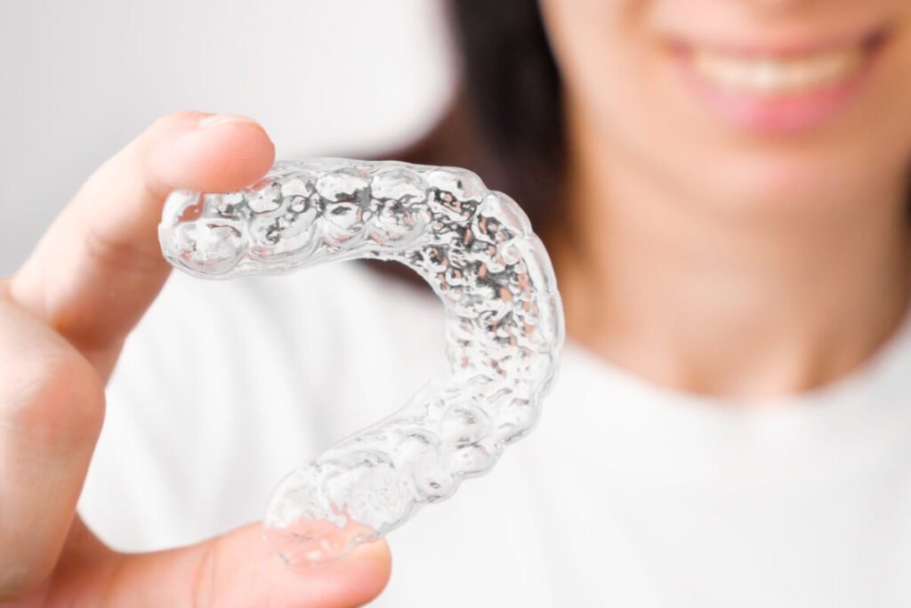 What Are The Common Questions About Invisalign?